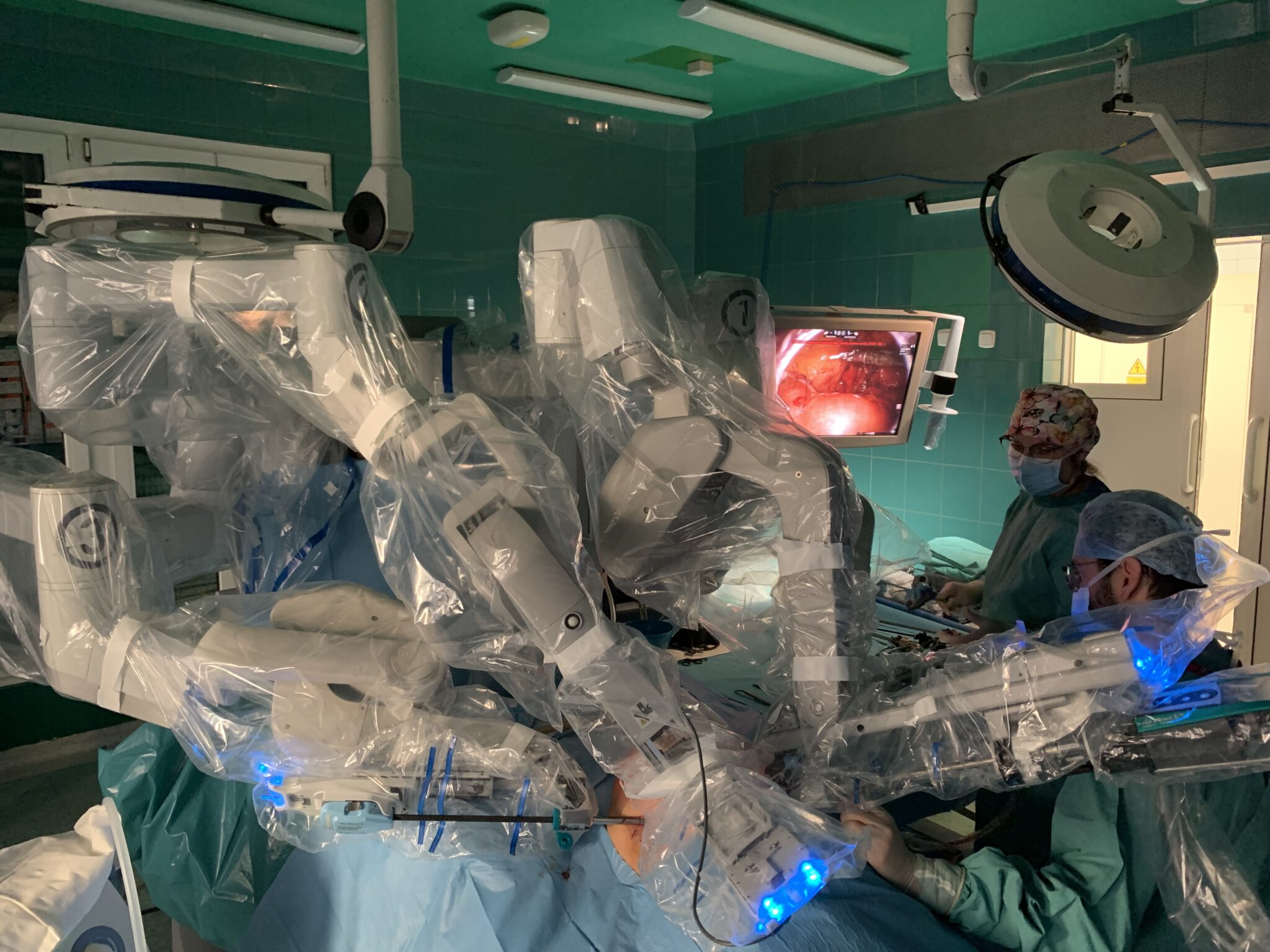 The first radical cystectomy using Da Vinci Robotic Surgical System ...